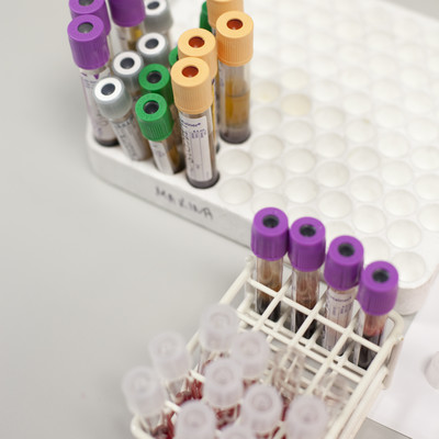 New pathology partnership to support patient care in south east London ...