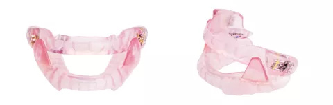 Mandibular repositioning appliance (MRA) - Overview | Guy's and St ...